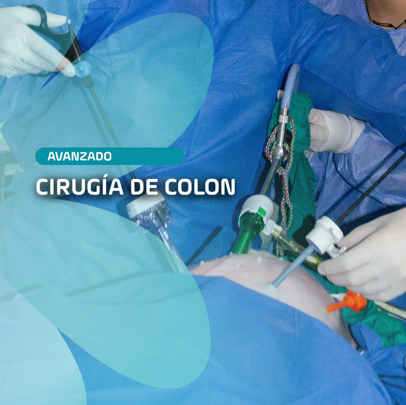 Cirugía Laparoscópica de Colon | Formación UNEQUIA Del 24 al 26 Junio ...